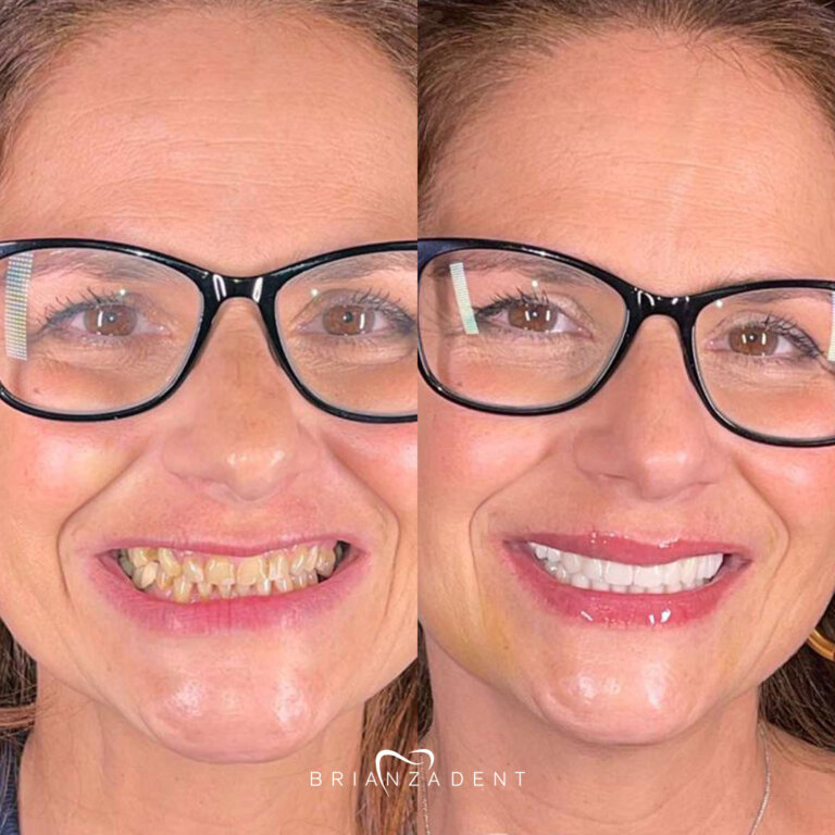 Home - Brianza Dent The Only Accredited Dental Clinic in Albania