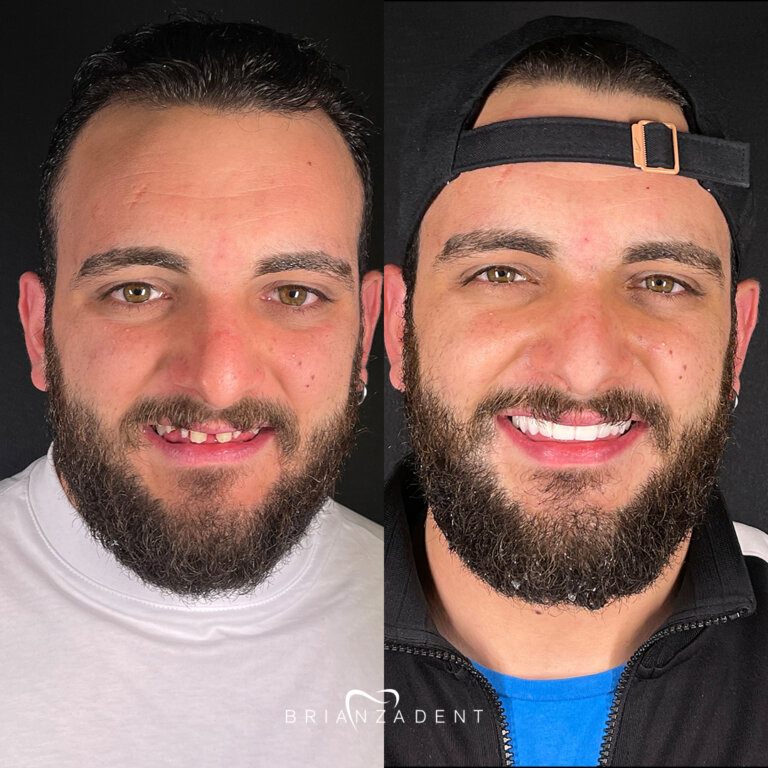 Home - Brianza Dent The Only Accredited Dental Clinic in Albania